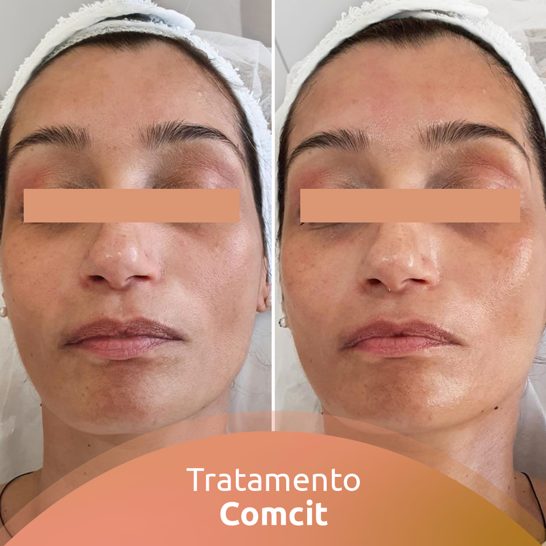 Comcit | Tratamento Estético | Corpus Slim